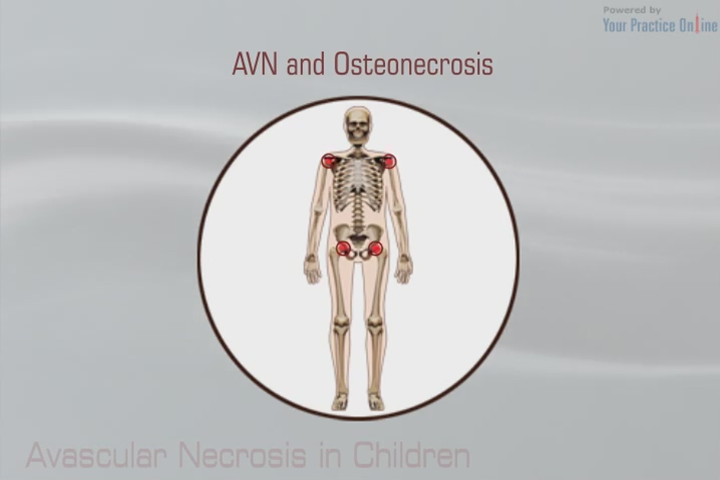 Avascular Necrosis in Children Video | Medical Video Library