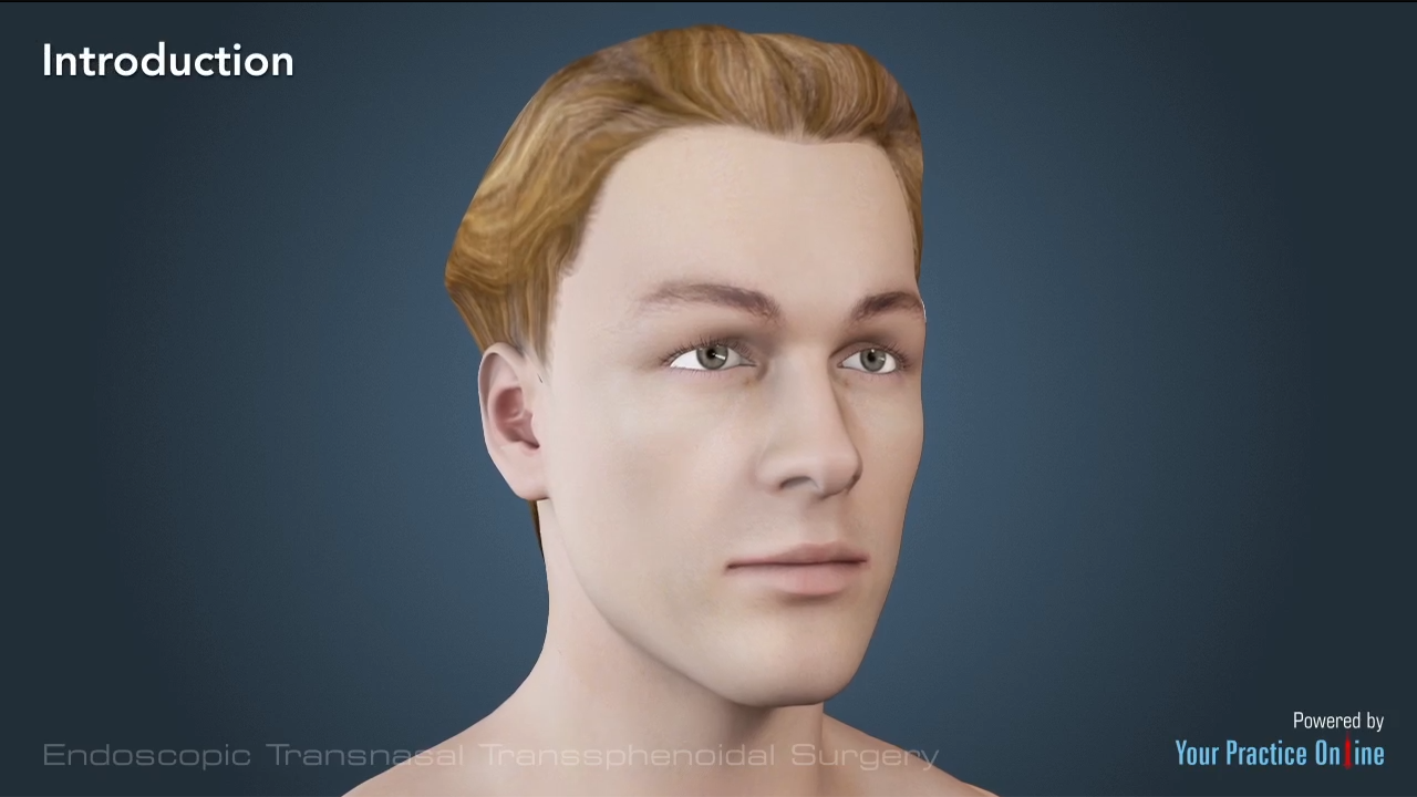 Endoscopic Transnasal Transphenoidal Surgery Video | Medical Video Library