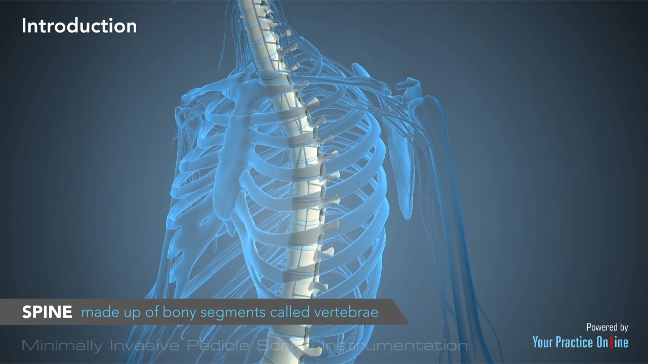 Pedicle Screw Instrumentation Video | Spinal Conditions Treatment Video