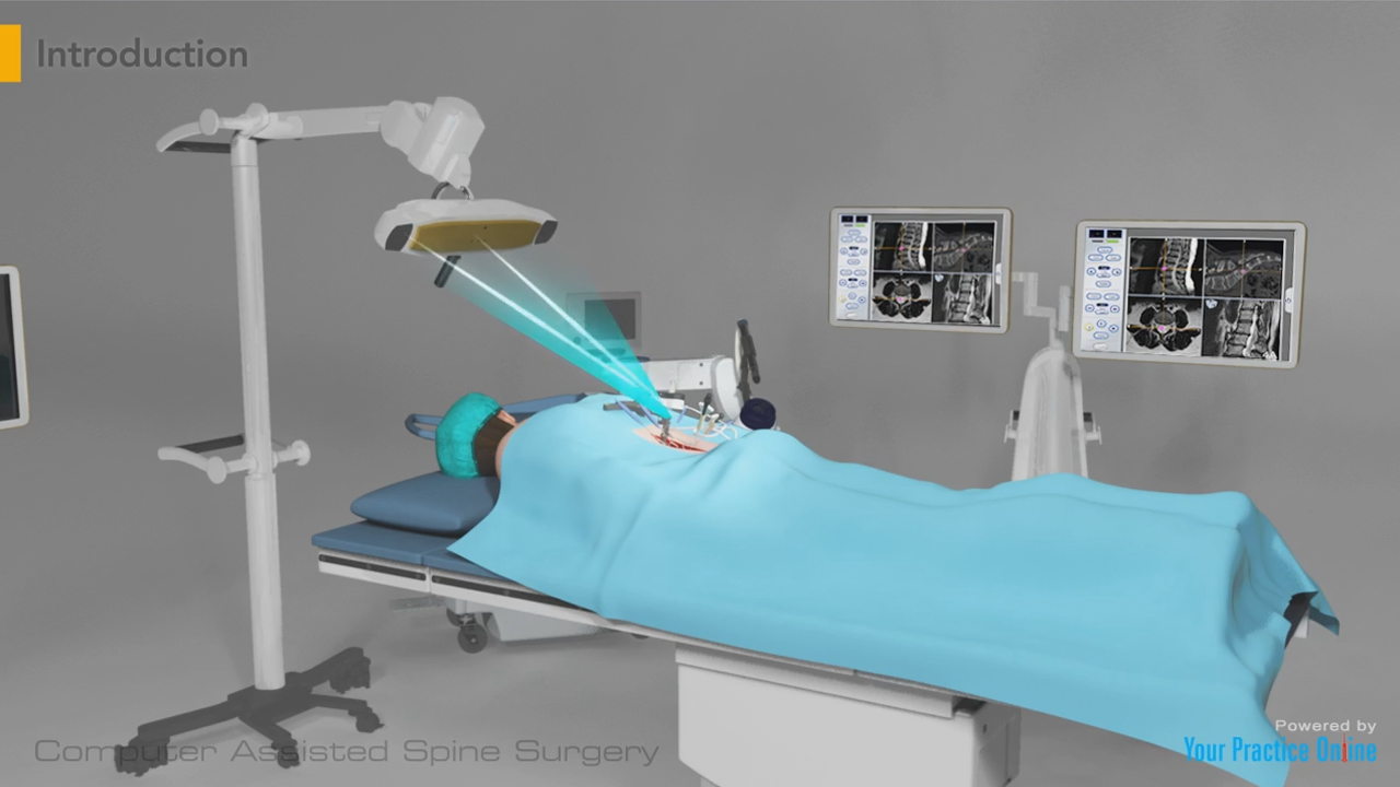 Computer Assisted Spine Surgery video | Spine Orthopedic Procedures Video