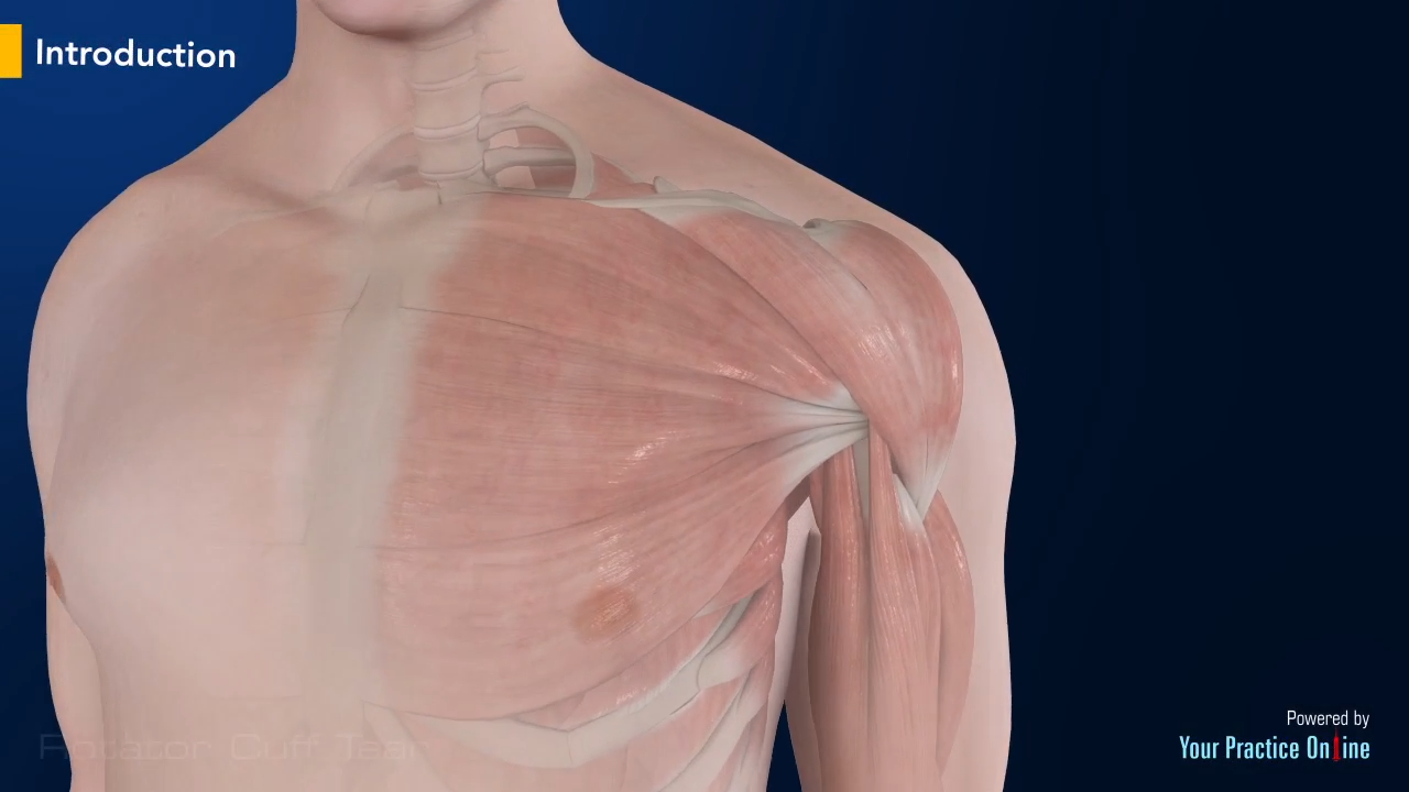 Rotator Cuff Tear Video | Medical Video Library