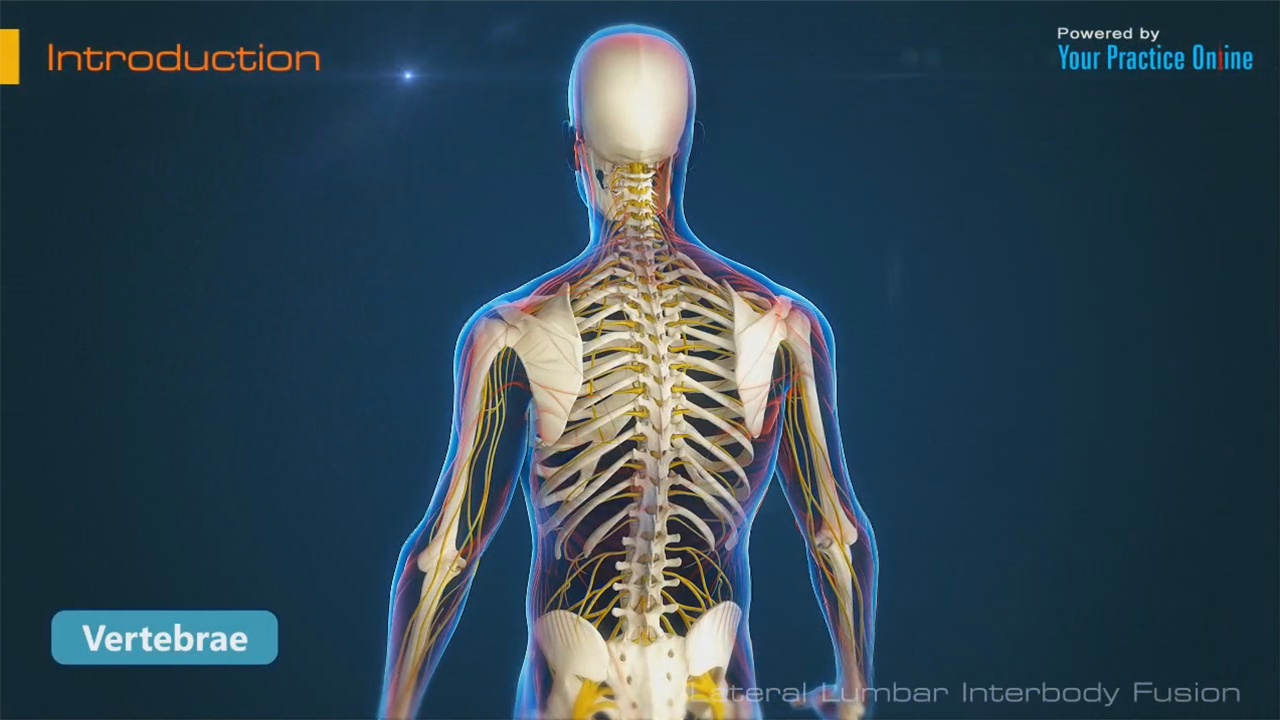 Lumbar Interbody Fusion Video | XLIF & DLIF Surgery Video | MIS Spine ...