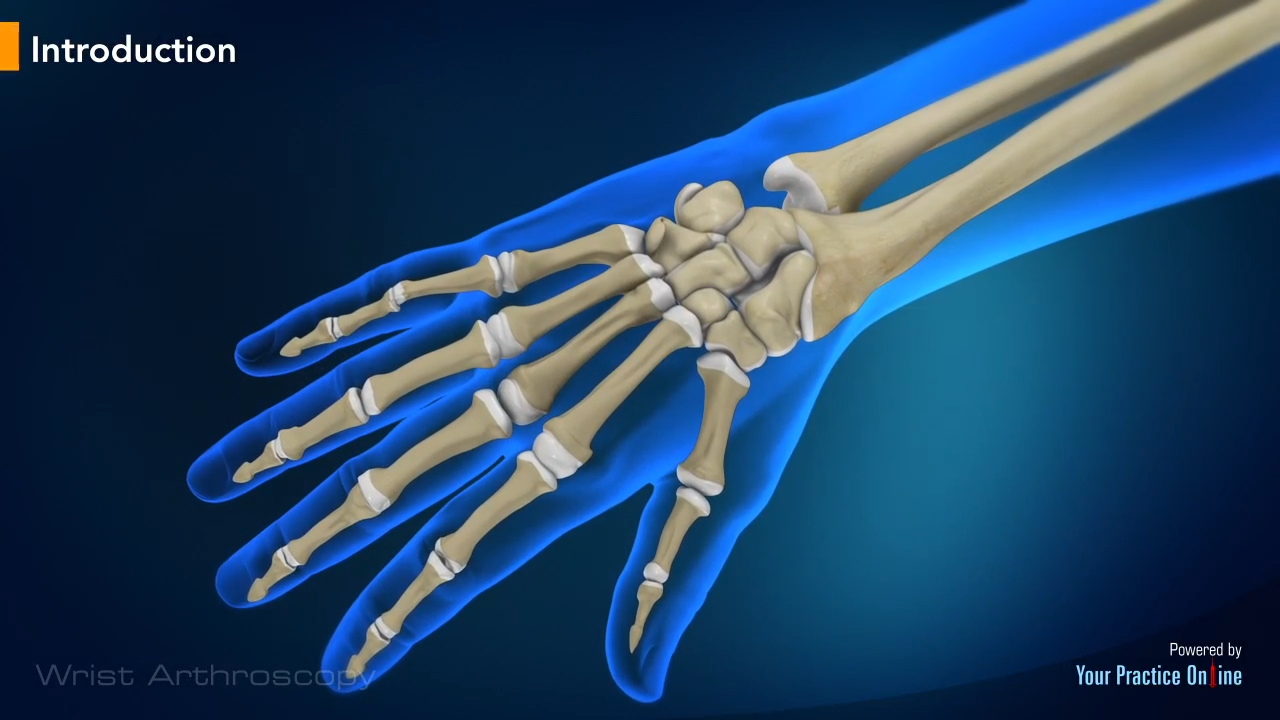 Wrist Arthroscopy Video | Medical Video Library