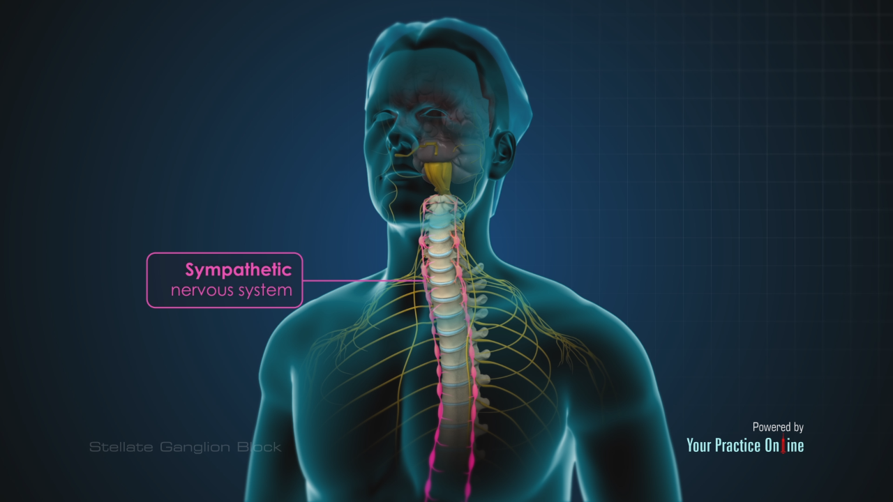 Stellate Ganglion Block Video | Medical Video Library