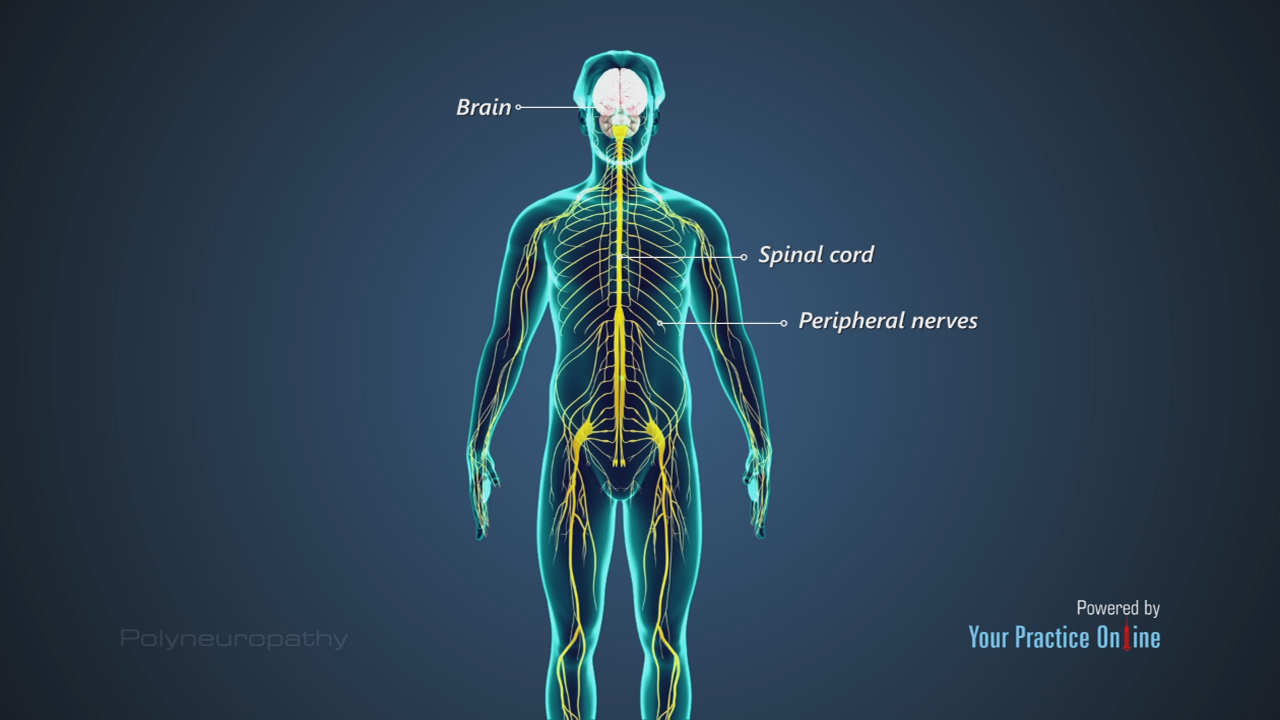 What Is Polyneuropathy