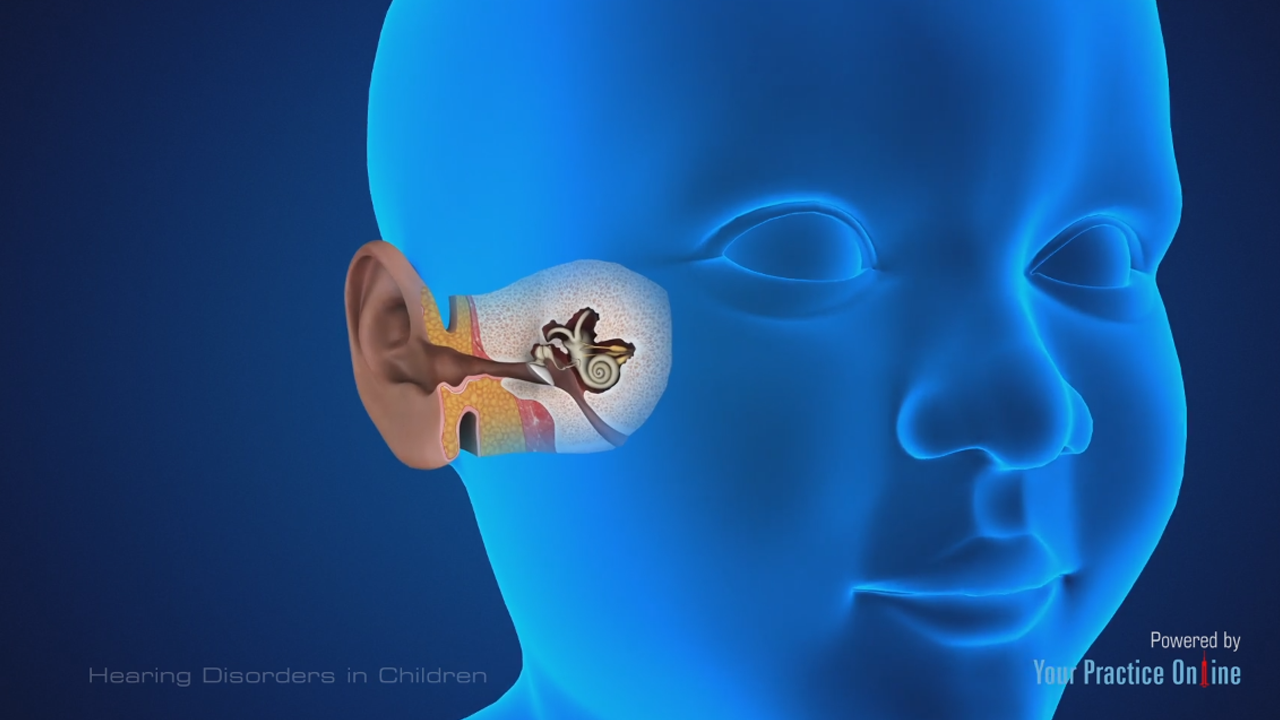 Hearing Disorders in children Video | Medical Video Library