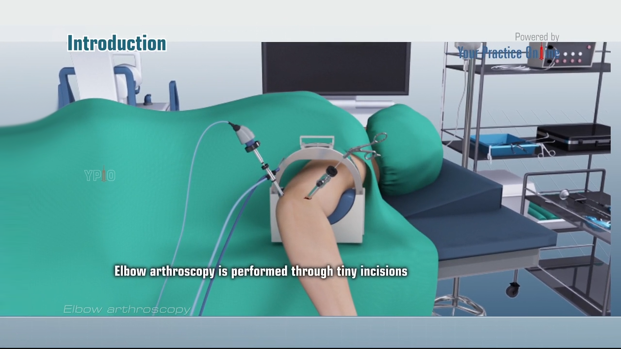 Elbow Arthroscopy Video | Medical Video Library