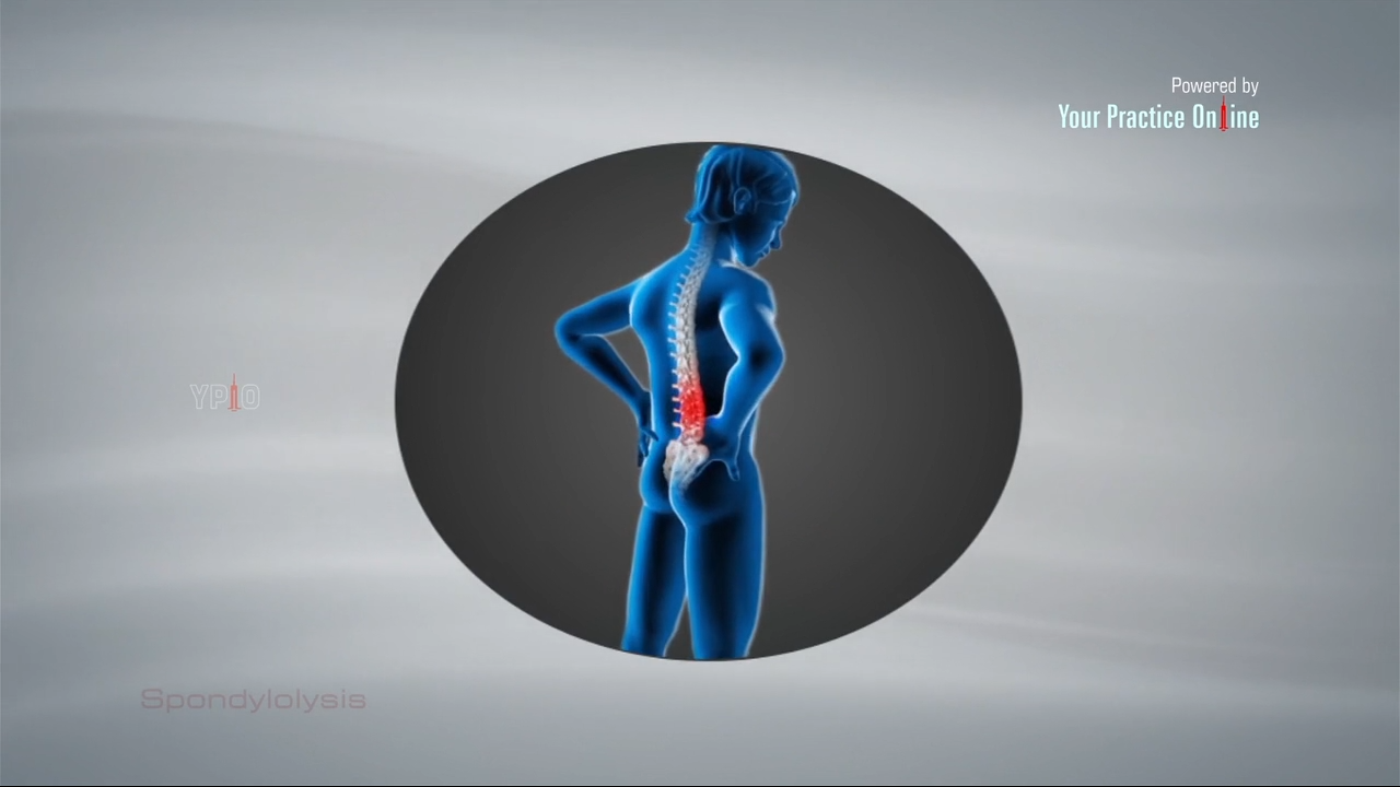 Title: Elbow Replacement Surgery | Your Practice Online Education