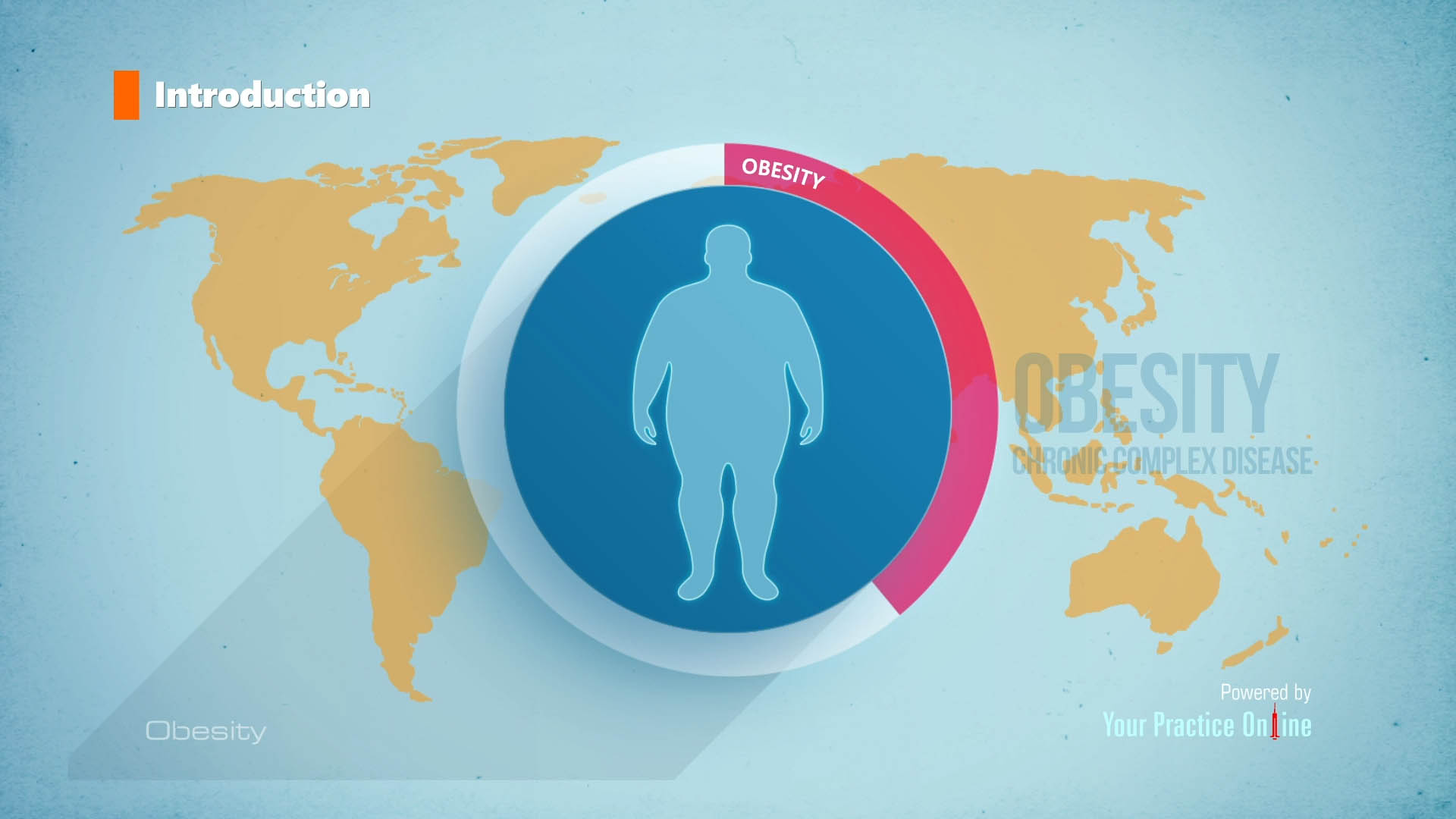 Obesity Surgery Video | Chronic Disease Conditions