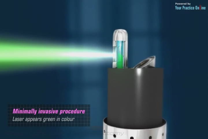 Green Light Laser Prostatectomy Video | Genitourinary Videos | YPO ...