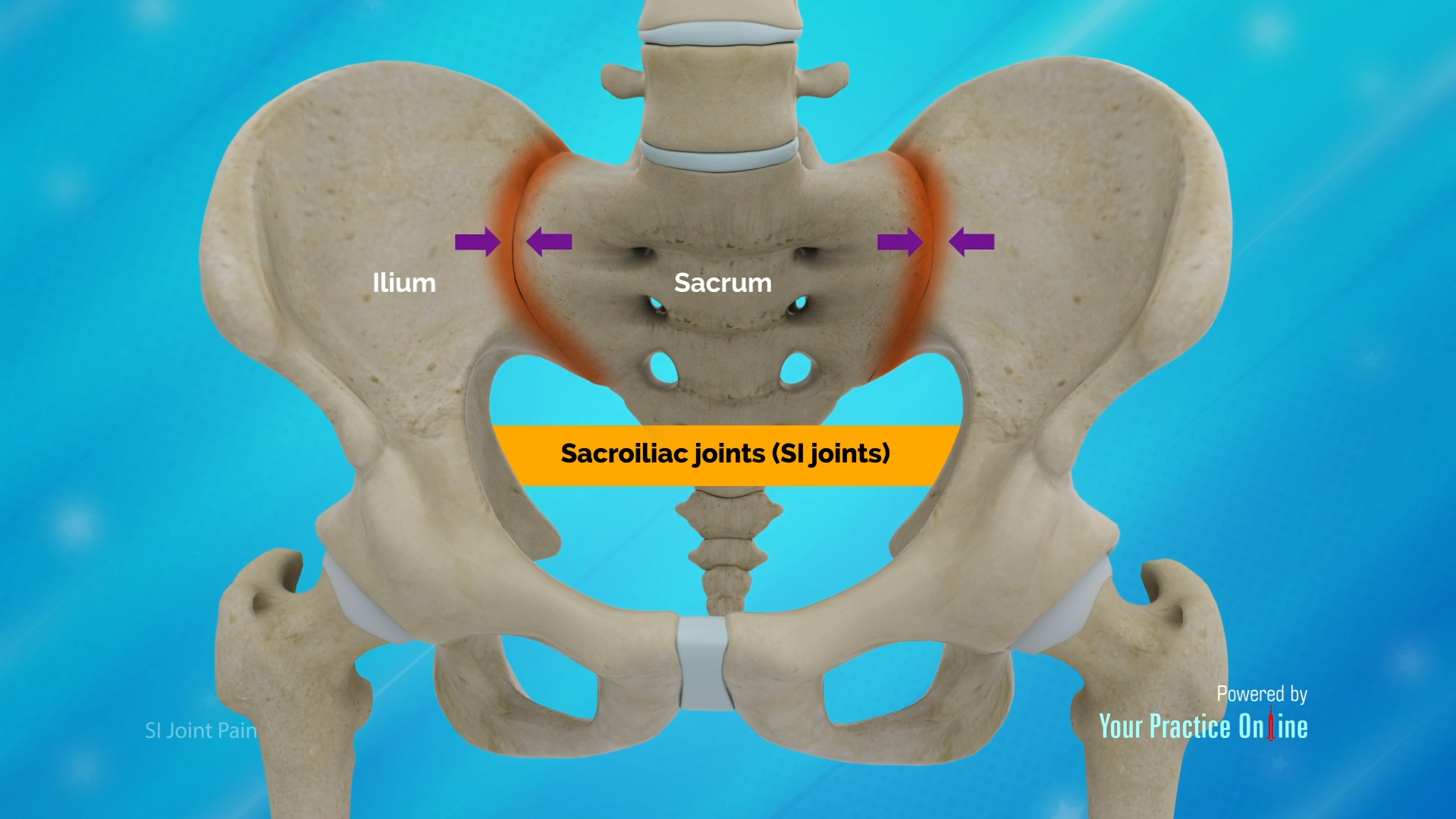 SI Joint Pain Video | Medical Video Library