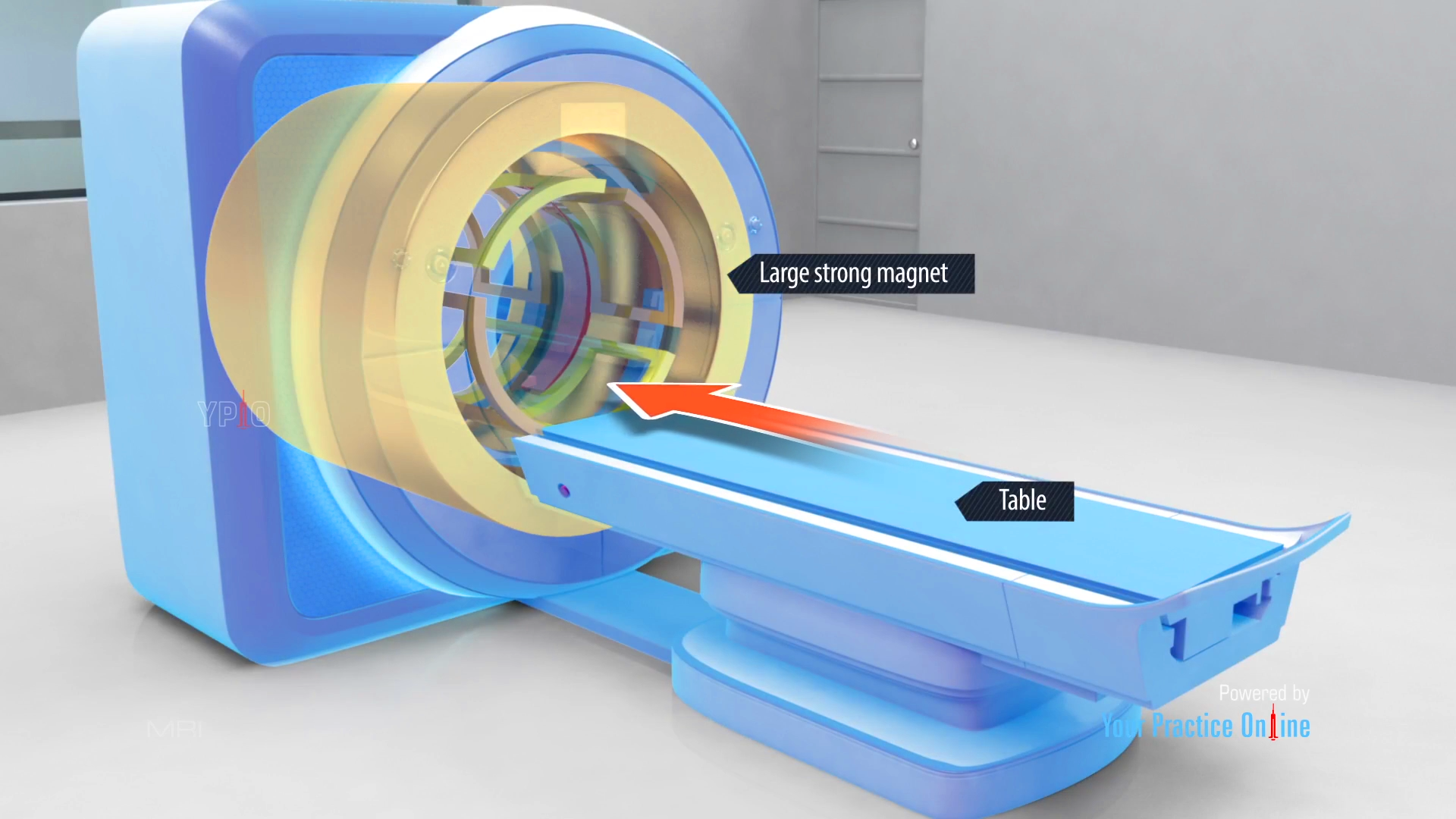 MRI Video | What is MRI Scan | MRI Scan Procedure & Benefits