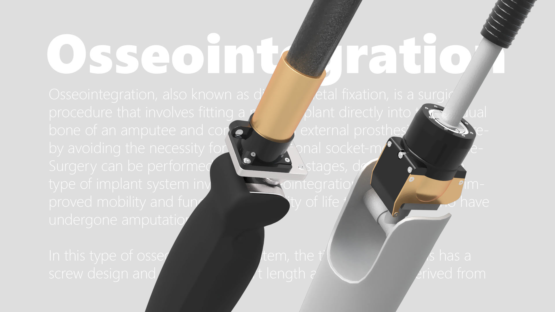 Osseointegration Video | Medical Video Library