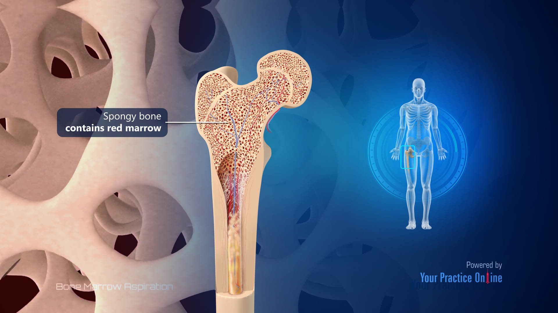 Bone Marrow Aspiration Video Medical Video Library