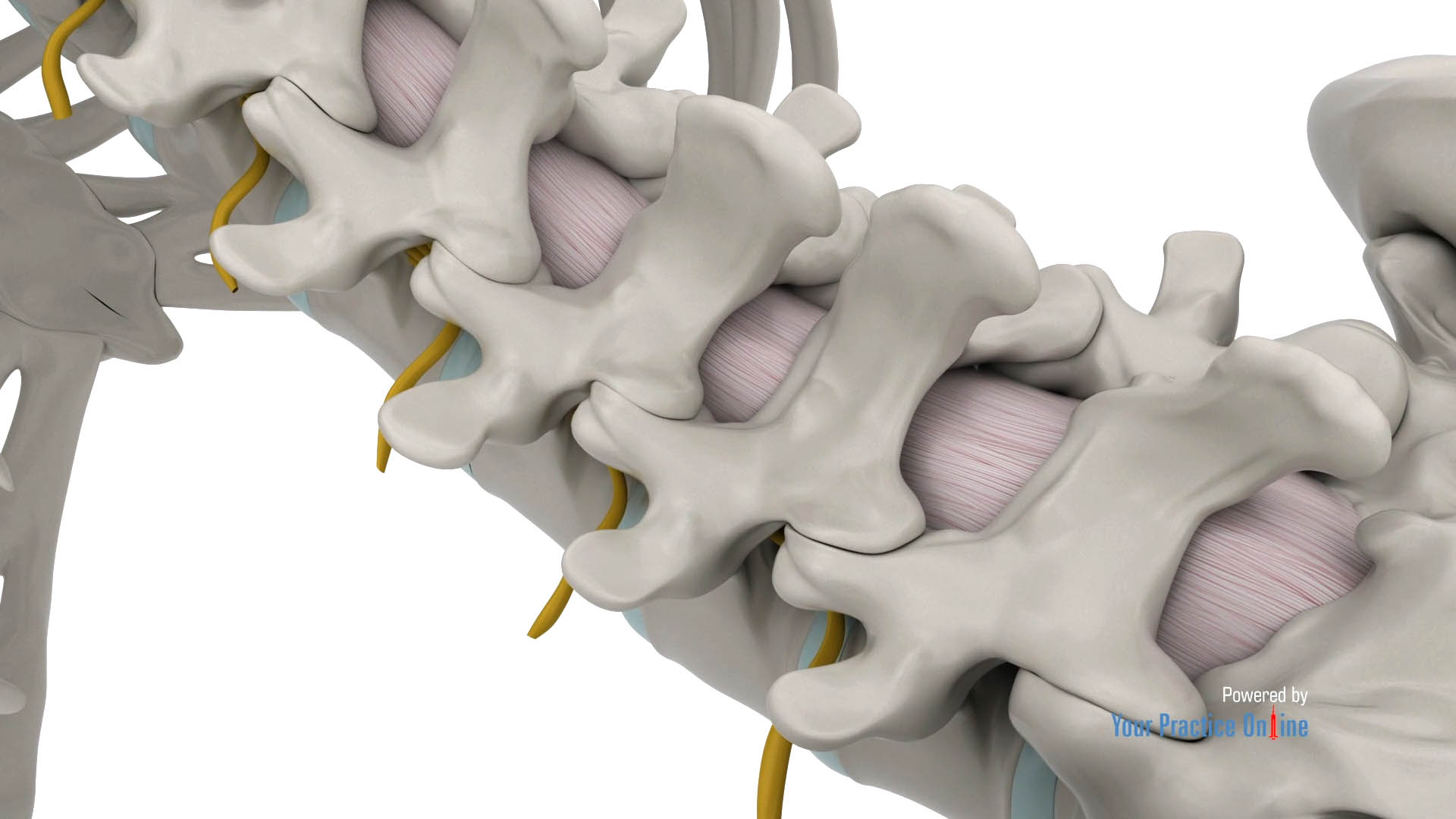 Minimally Invasive Lumbar Discectomy Video | Medical Video Library