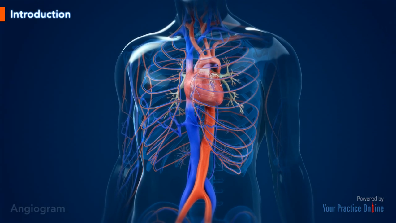 Angiogram Video | Medical Video Library