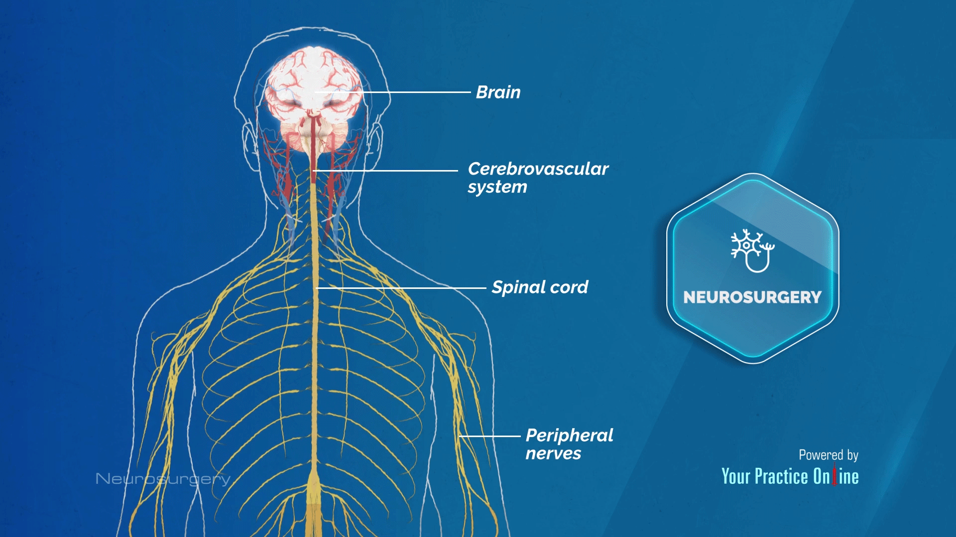 Neurosurgery Video | Medical Video Library