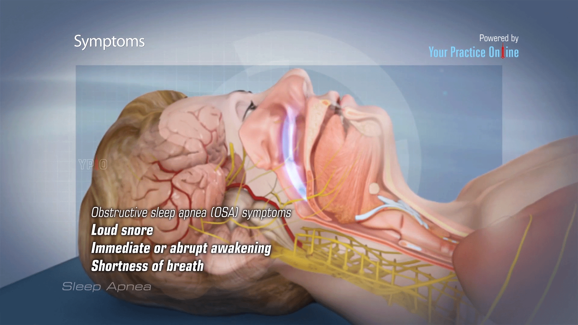 What Is Sleep Apnea? | Sleep Apnea Videos | Sleep disorder