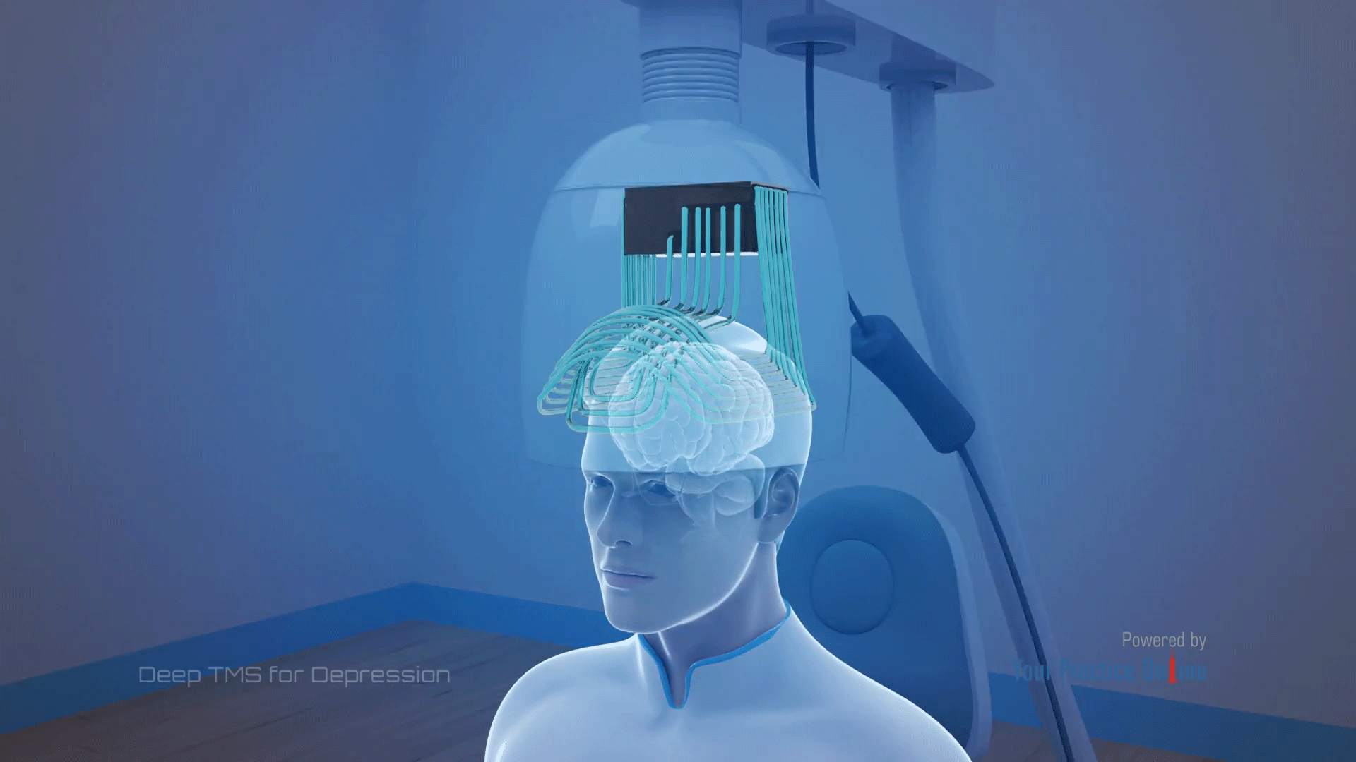 Deep TMS for Depression Video | Medical Video Library