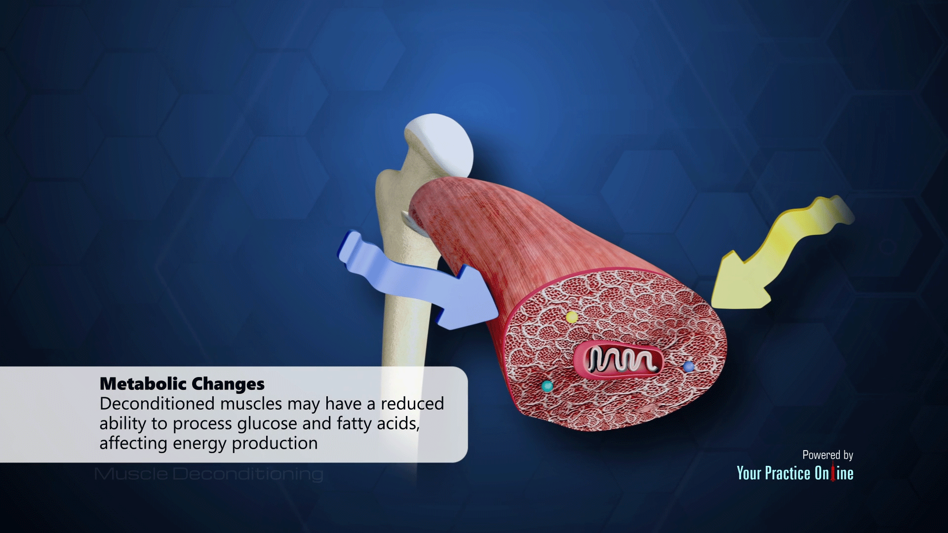 Muscle Deconditioning Video | Medical Video Library