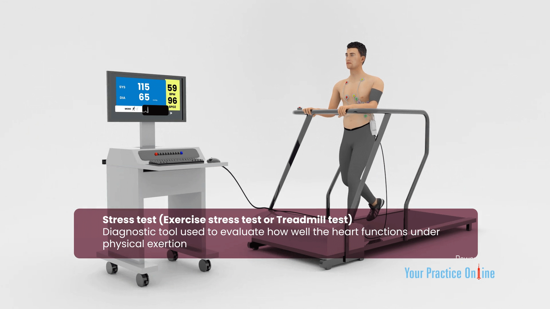 Stress Test Video | Medical Video Library