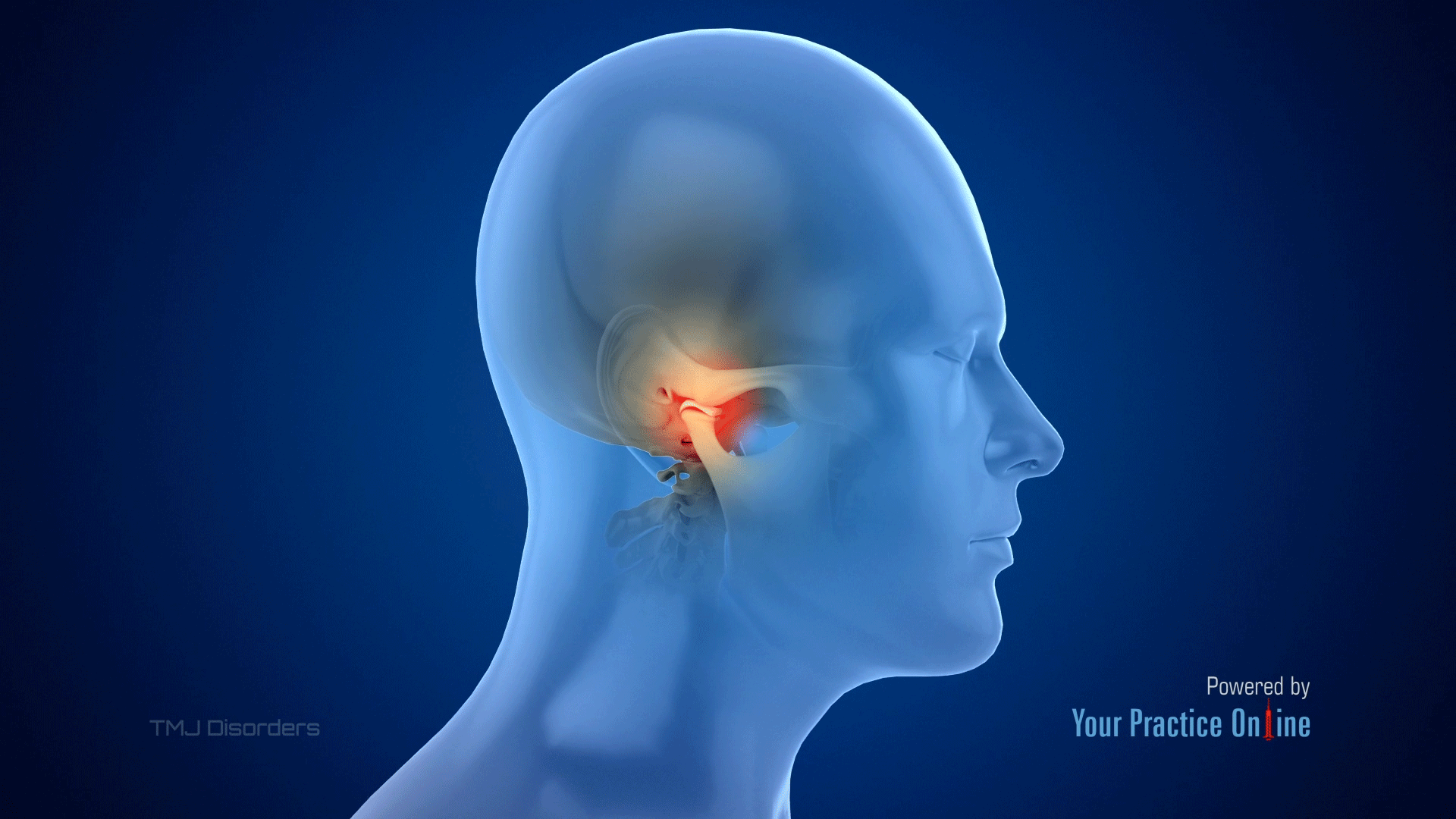 TMJ Disorders Video | Medical Video Library