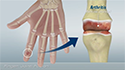 Orthopaedics | Orthopedic Surgery Videos | Your Practice Online Education